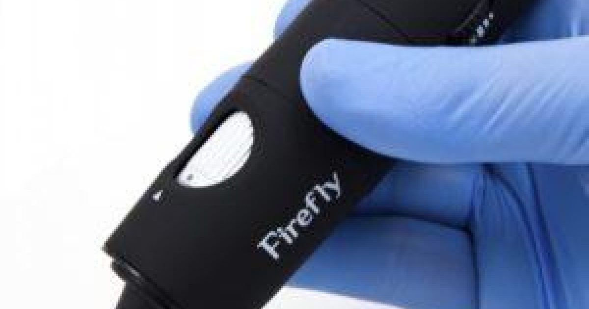 Firefly USB Otoscope